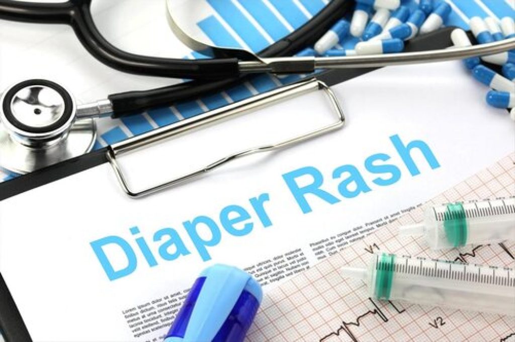 9 Ways To Get Rid of a Diaper Rash Naturally – Natural Diaper Rash ...
